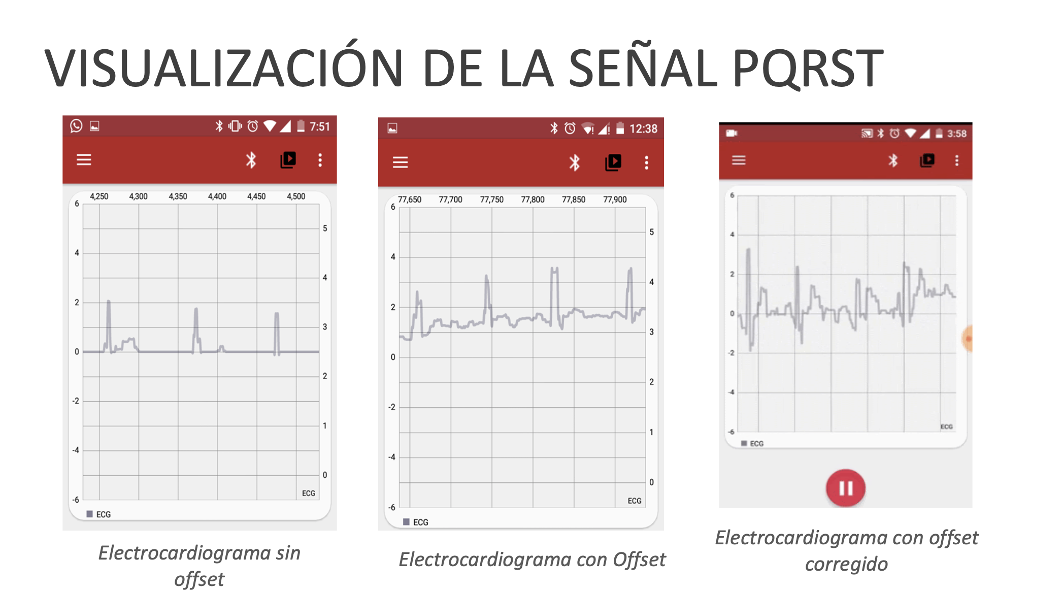 GitHub - KevinAlexis/Android-Electrocardiogram: Aplicación que recibe ...