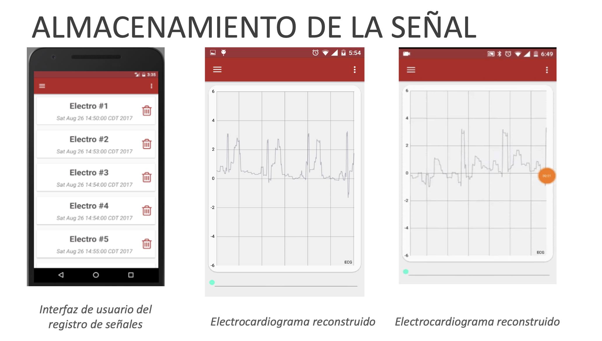 GitHub - KevinAlexis/Android-Electrocardiogram: Aplicación que recibe ...